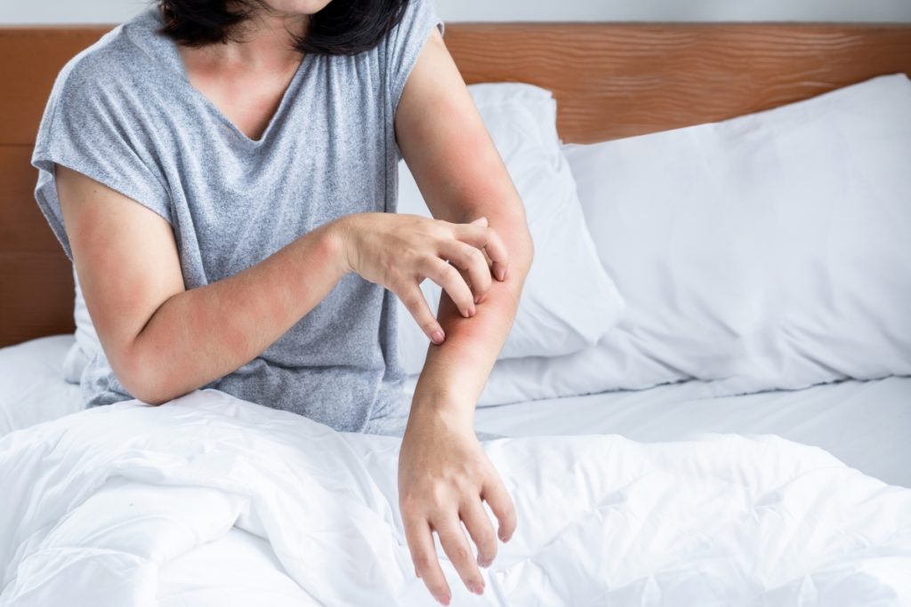 Protect Your Mattress from Dust Mites